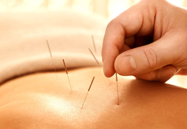 Holistic Universal Hospital - Acupuncture TCM